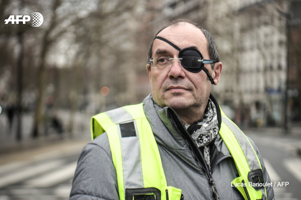 Patrick Galliand | 팩트체크